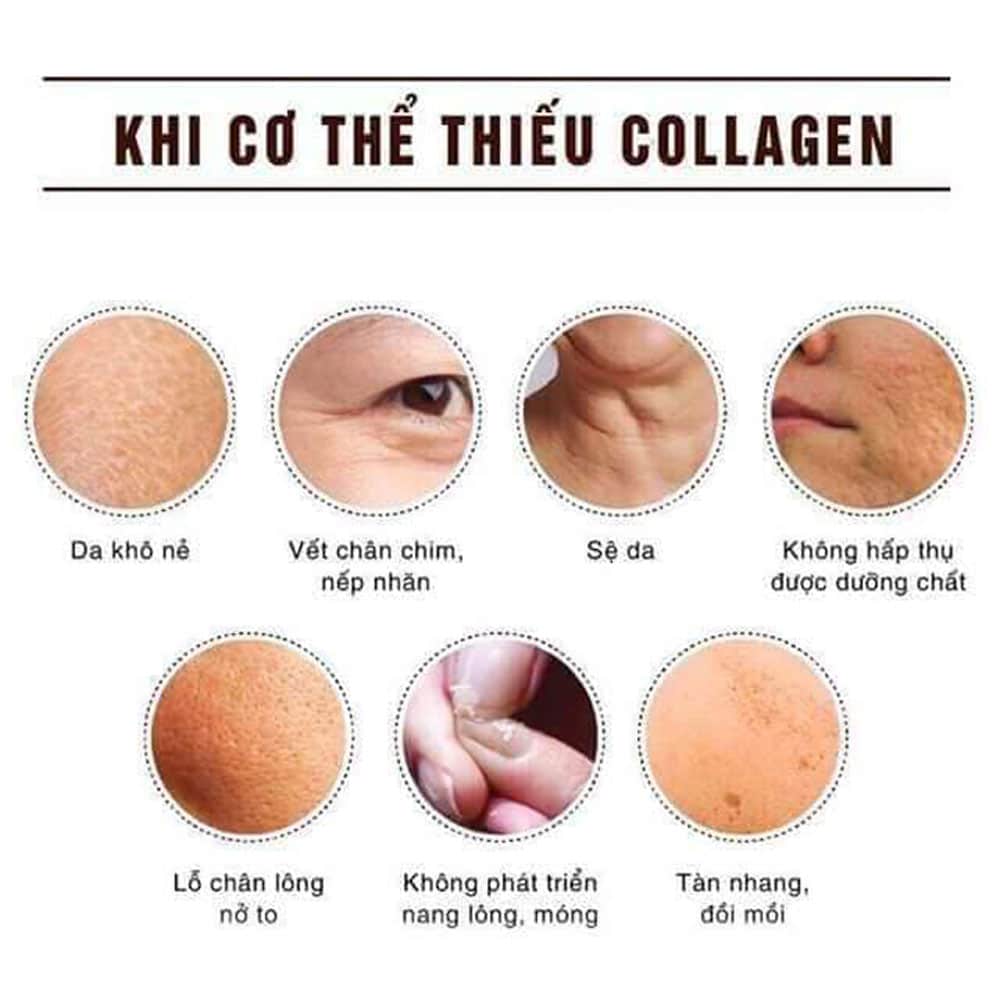 Collagen nước Madre:X Ex:beaute Collagen 20000 Plus 50ml x10 chai ...